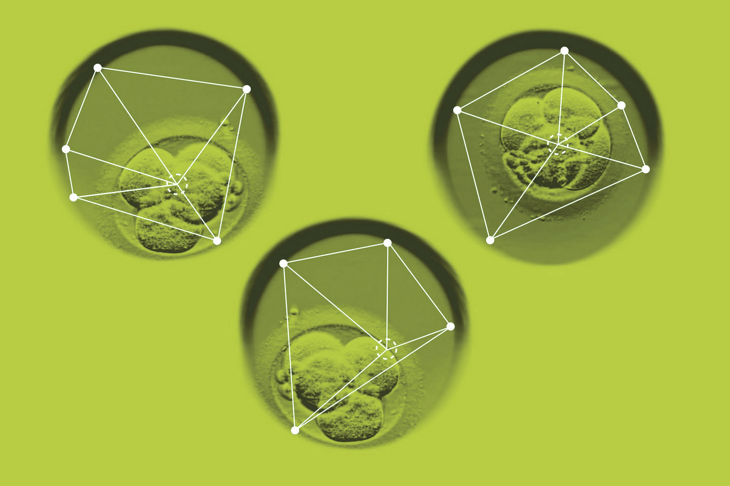 Embryoutval med time-lapse och artificiell intelligens | Embio IVF Center